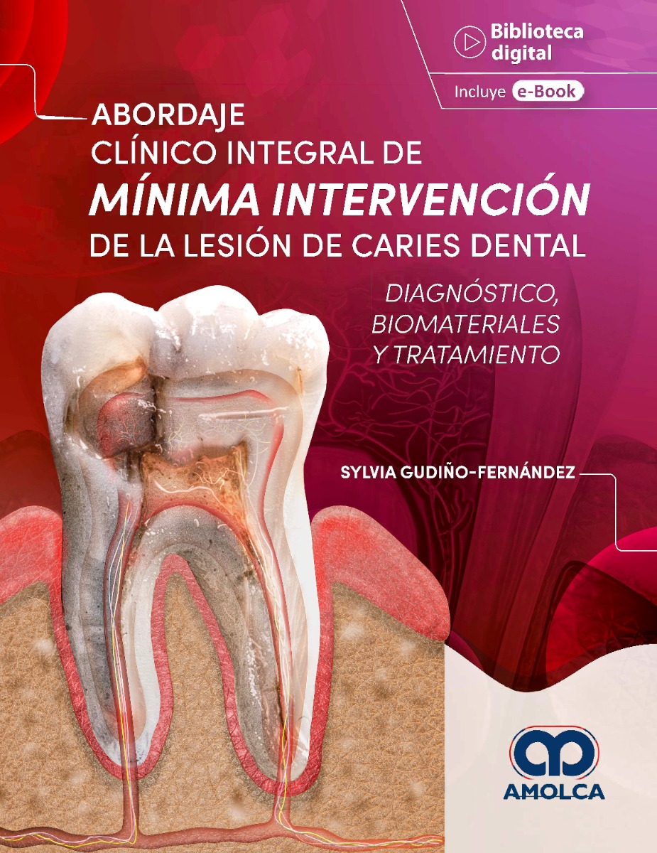 Abordaje Clínico Integral de Mínima Intervención de la Lesión de Caries ...
