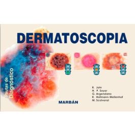 Dermatoscopia. Pautas de Diagnóstico